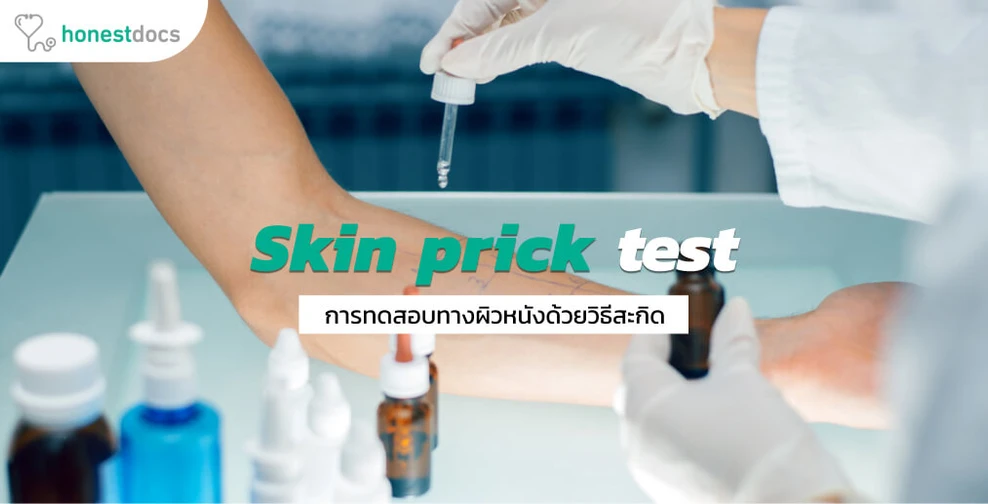 Skin Prick Test ทดสอบภูมิแพ้ทางผิวหนังด้วยวิธีสะกิด