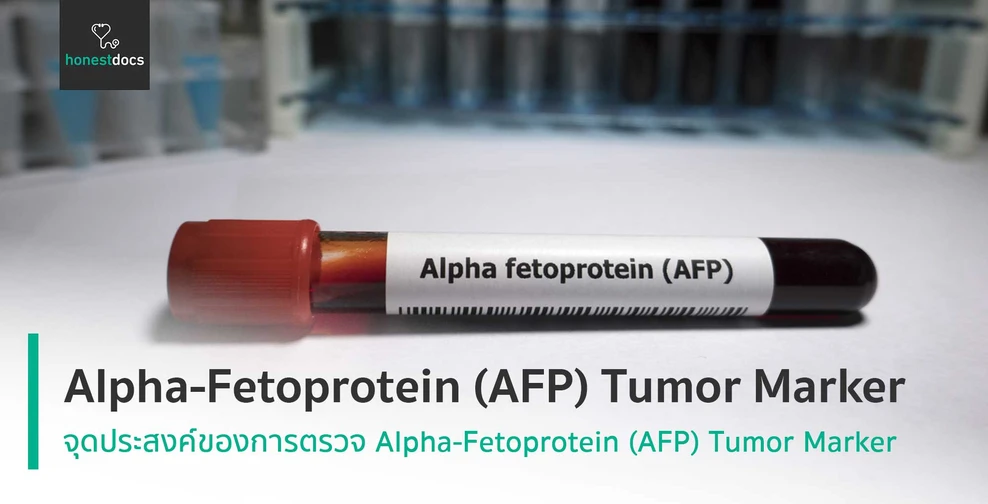 AFP (Alpha-Fetoprotein Tumor Marker) คืออะไร?