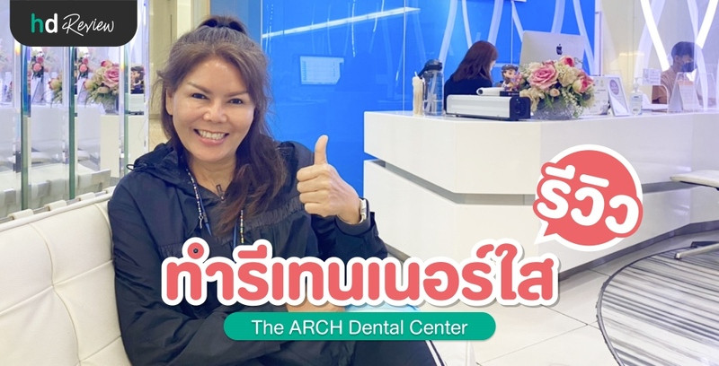 รีวิว ทำรีเทนเนอร์ใส ที่ The ARCH Dental Center - HDmall Blog