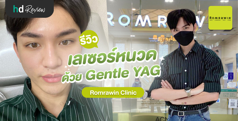 รีวิว เลเซอร์หนวด ด้วย Gentle YAG ที่ Romrawin Clinic - HDmall Blog