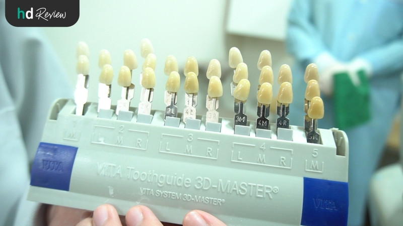 รีวิวฟอกสีฟัน Cool Light และชุดฟอกสีฟัน ที่ Grace Dental Clinic ...