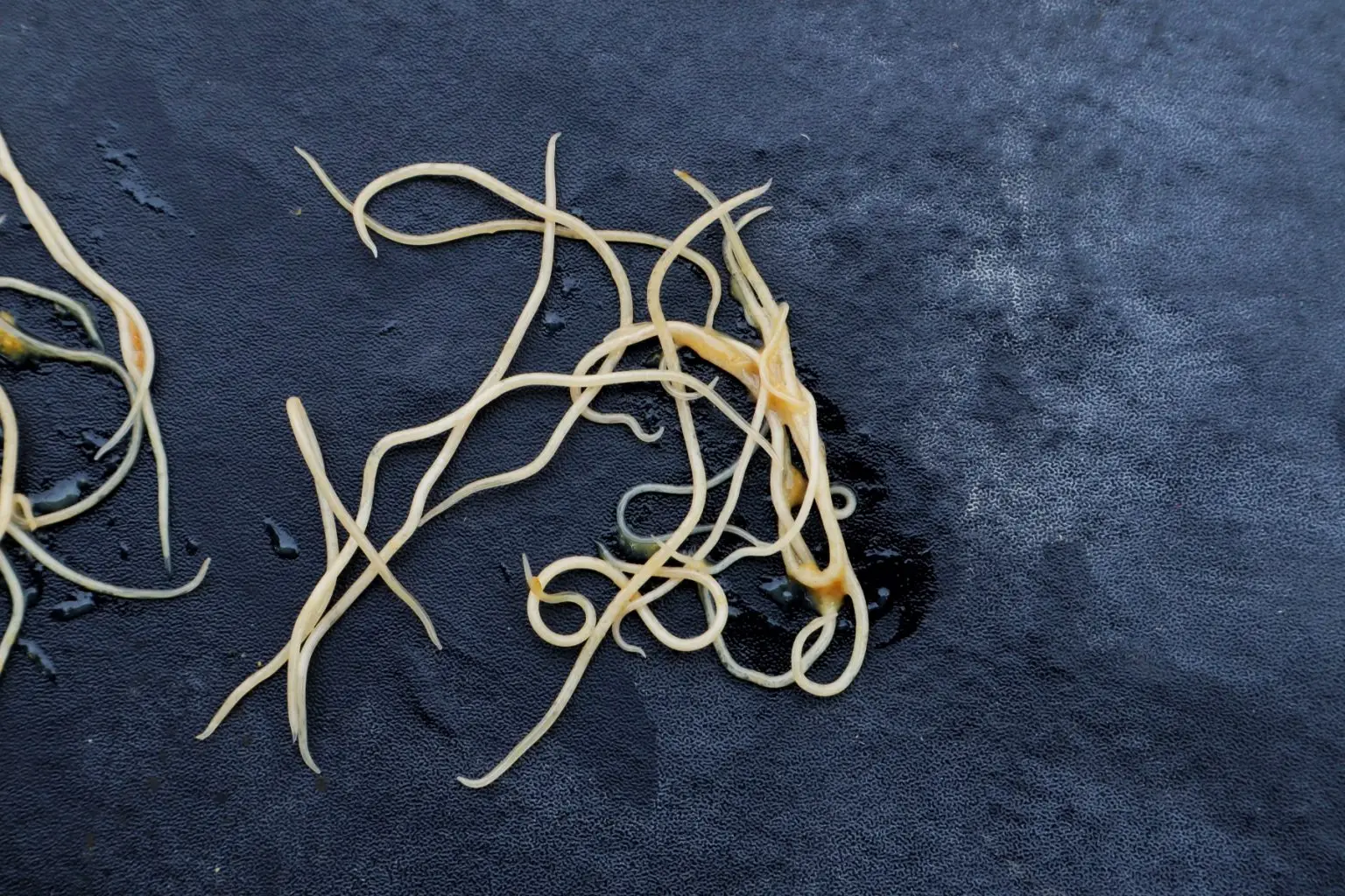 พยาธิเส้นด้าย สาเหตุ อาการ วิธีรักษา การป้องกัน