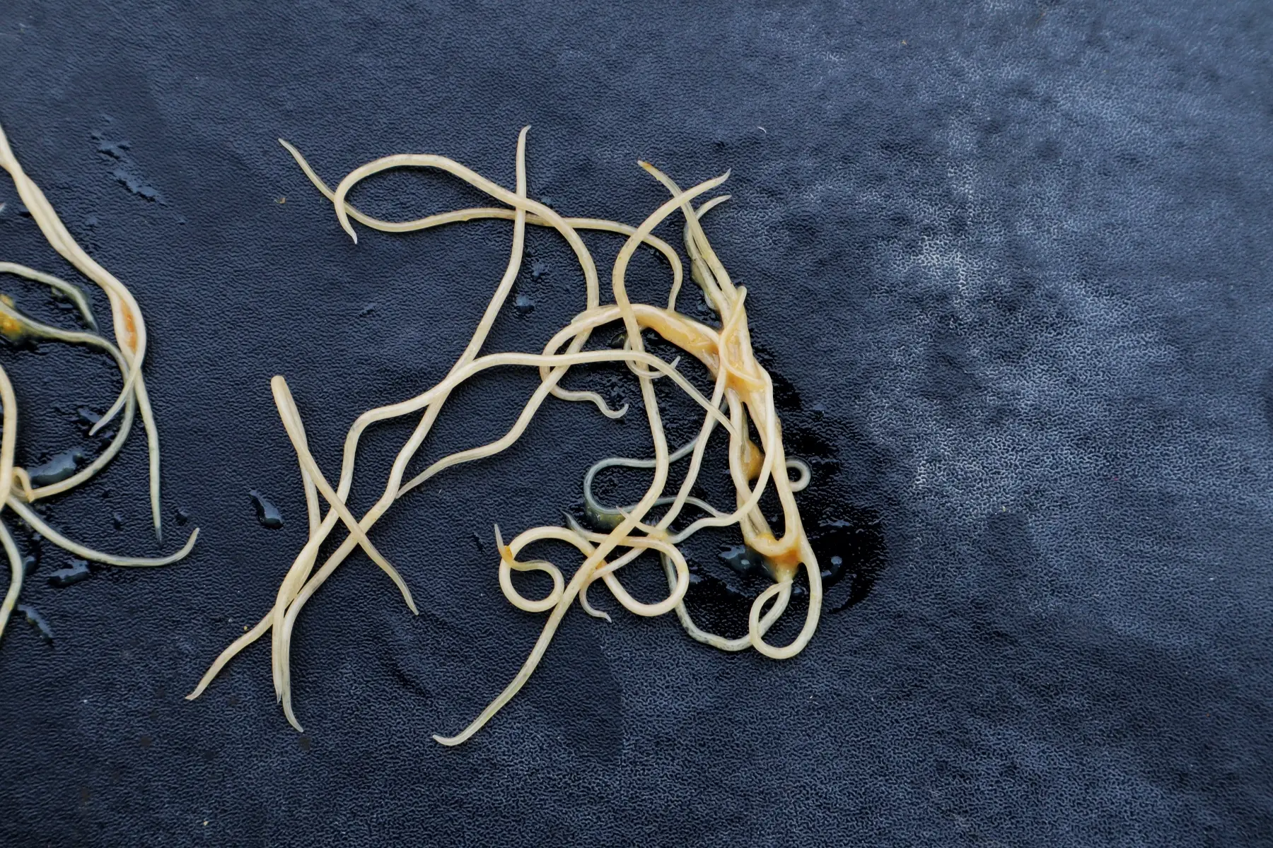 พยาธิเส้นด้าย สาเหตุ อาการ วิธีรักษา การป้องกัน