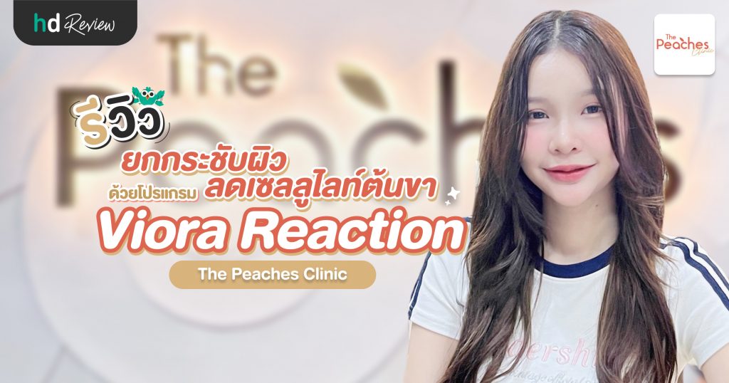 รีวิวยกกระชับผิว ลดเซลลูไลท์ต้นขาด้วยโปรแกรม Viora Reaction ที่ The Peaches Clinic