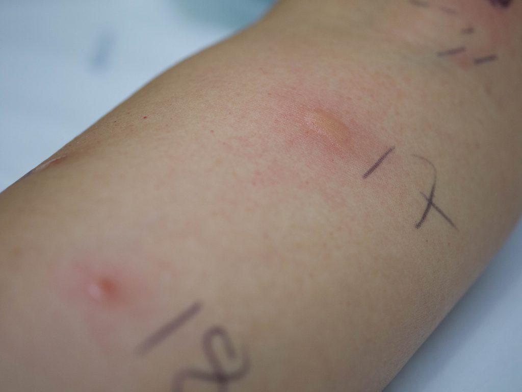 คลอโรฟิลล์ ประโยชน์ สรรพคุณ โทษ ข้อควรระวัง