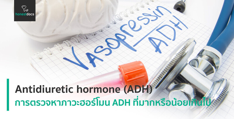 การตรวจ Antidiuretic hormone (ADH) หาภาวะขาดและเกิน