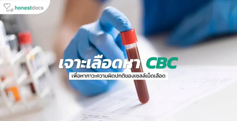 CBC วิธีอ่านค่า เกล็ดเลือดปกติเท่าไหร่ เข้าใจง่าย