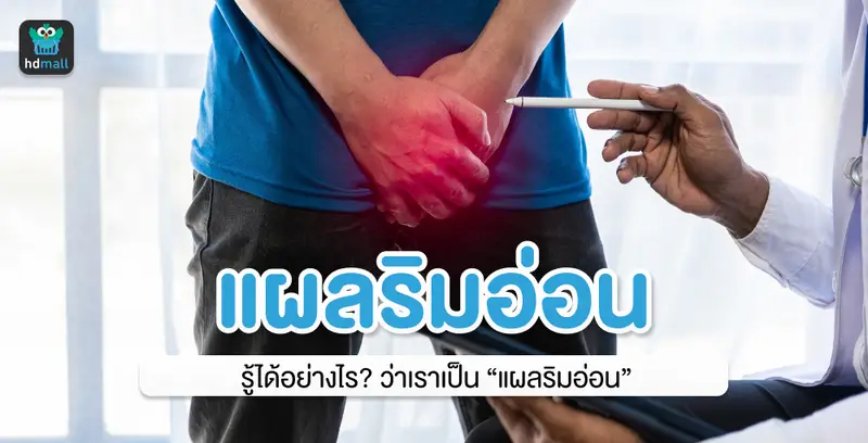 แผลริมอ่อน คืออะไร อาการ วิธีป้องกัน การรักษา