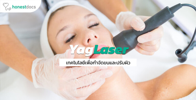 YAG Laser คืออะไร ข้อดี ข้อเสีย ข้อควรระวัง สิ่งที่ควรทราบ