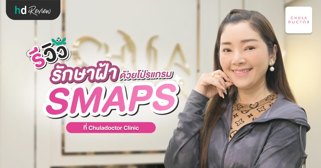 รีวิวรักษาฝ้า ด้วยโปรแกรม SMAPS ที่ Chuladoctor Clinic