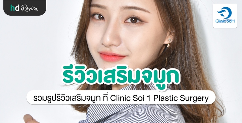 รีวิว เสริมจมูก ที่ Clinic Soi 1 Plastic Surgery - HDmall Blog