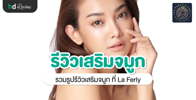 รีวิว เสริมจมูก ที่ La Ferly Clinic - HDmall Blog