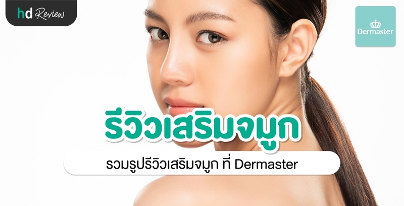 รีวิว เสริมจมูก ที่ Dermaster - HDmall Blog