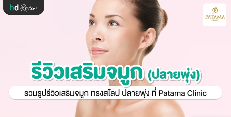 รีวิว เสริมจมูก ทรงสโลป ปลายพุ่ง ที่ Patama Clinic - HDmall Blog