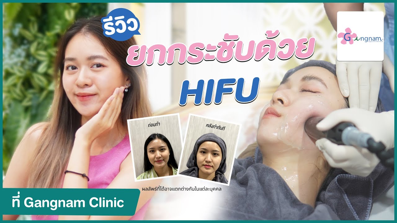 รีวิว ทำ HIFU ที่ Gangnam Clinic - HDmall Blog