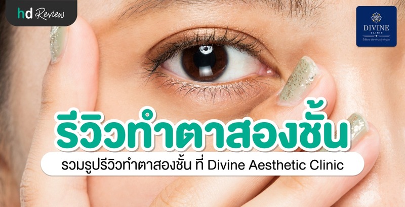 รีวิวทำตา 2 ชั้น ที่ Divine Aesthetic Clinic - HDmall Blog